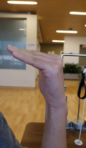 Elbow and Hand Exercises - Welcome to MedNev